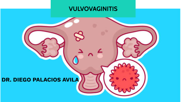 VULVOVAGINITIS by diego palacios on Prezi