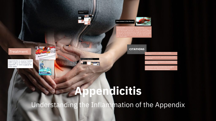Appendicitis Overview by Thelma Coronel on Prezi