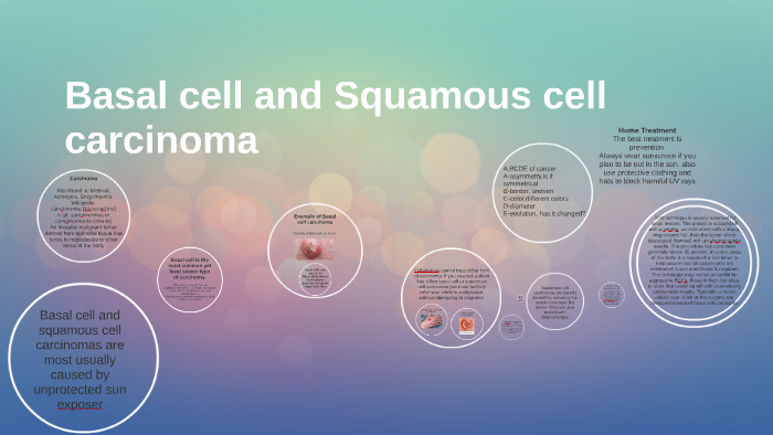 Basal cell and Squamous cell carcinoma by Laura Kelso on Prezi