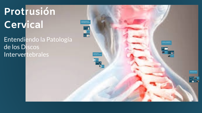 Protrusión Cervical by Luis Enrique Flores Avila on Prezi