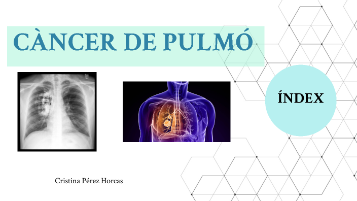 CÀNCER DE PULMÓ by cristina Pérez Horcas on Prezi