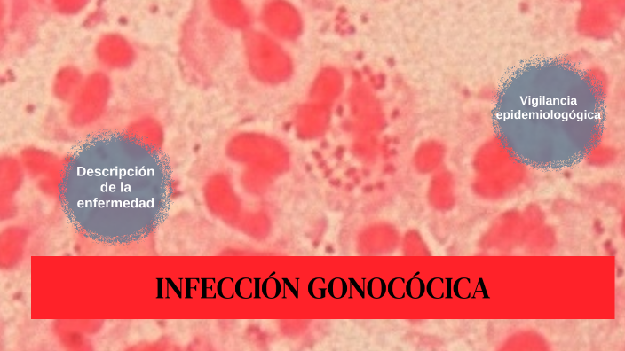 Infección Gonocócica by Wendy Carolina Herrera Velasquez on Prezi