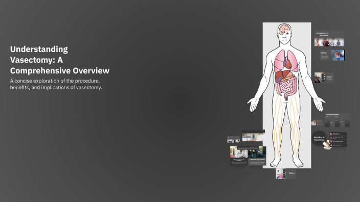 Understanding Vasectomy: A Comprehensive Overview by Jehvon Sean Villar ...