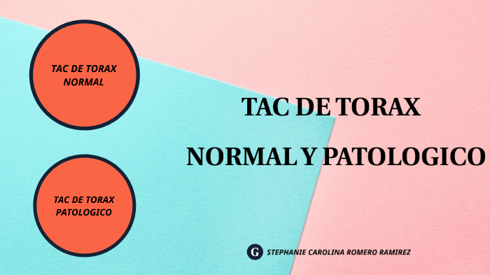 TAC DE TORAX NORMAL Y PATOLOGICO by Stephanie Romero on Prezi