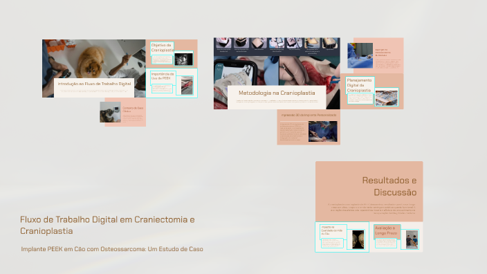 Fluxo de Trabalho Digital em Craniectomia e Cranioplastia by Polyanne ...