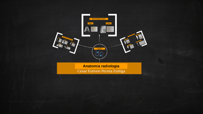 conceptualización anatómica by Cesar Pernia on Prezi