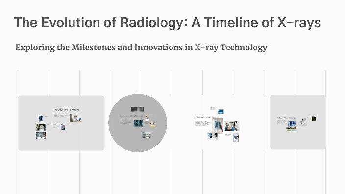 The Evolution of Radiology: A Timeline of X-rays by Lyndsey Koster on Prezi