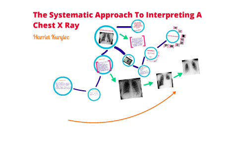 A systematic approach to interpreting a Chest X-Ray by Harriet Kurylec ...