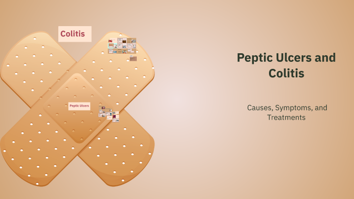 Understanding Peptic Ulcers and Colitis by Katherine Dungan on Prezi