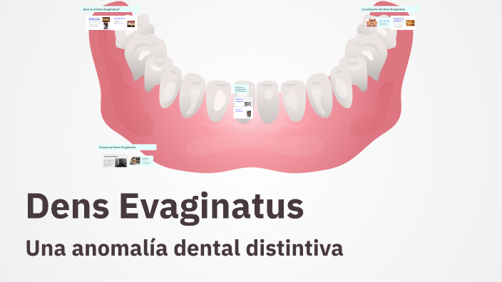 Dens Evaginatus by GERALDINE YURLEY NASAMUES RIVADENEIRA on Prezi