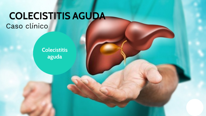 COLECISTITIS AGUDA by Alba Ayala on Prezi