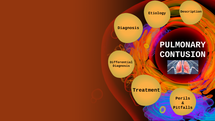 Pulmonary Contusion by Loni Pisani on Prezi