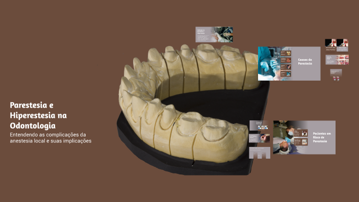 Parestesia e Hiperestesia na Odontologia by Daniela Medina on Prezi