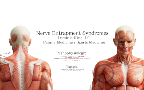 Nerve Entrapment Syndromes by Dominic King on Prezi