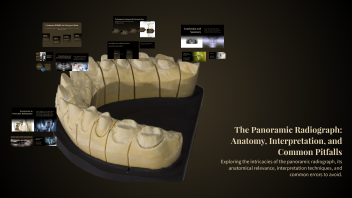 The Panoramic Radiograph: Anatomy, Interpretation, and Common Pitfalls ...
