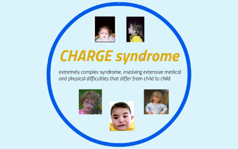 CHARGE syndrome by Colleen Hussey on Prezi