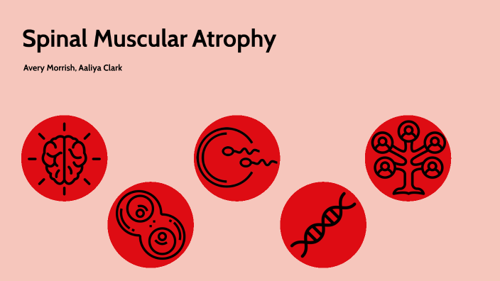 Spinal Muscular Atrophy by Avery Morrish on Prezi