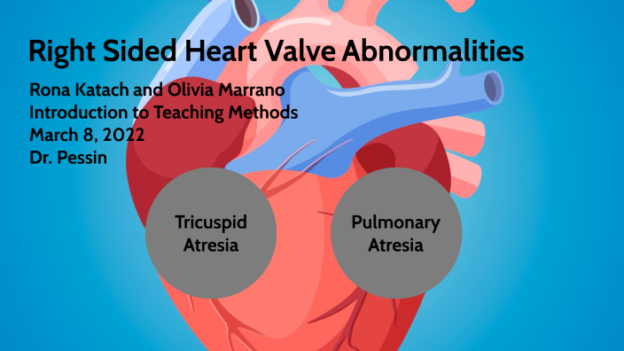Right Sided Heart Abnormalities by Olivia Marrano on Prezi