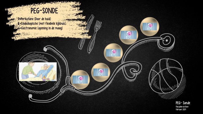 PEG_Sonde TT by mm boer on Prezi