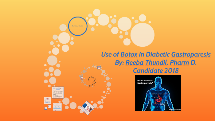 Use of Botox In Diabetic Gastroparesis by Reeba Thundil on Prezi