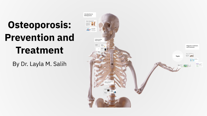 Osteoporosis: Prevention and Treatment by layla salih on Prezi