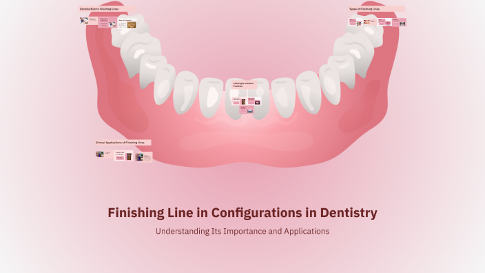 Finishing Line in Configurations in Dentistry by Ceren Baran on Prezi