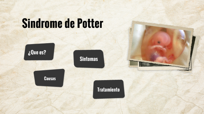 Síndrome de Potter by Melissa Estrada on Prezi