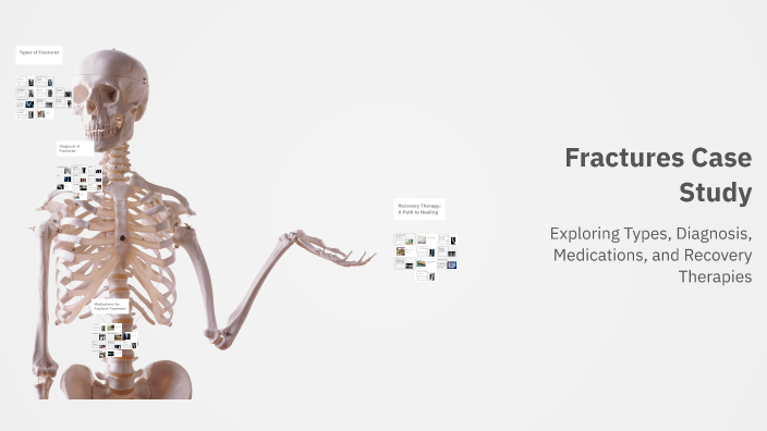 Fractures Case Study by Valerie Roberts on Prezi