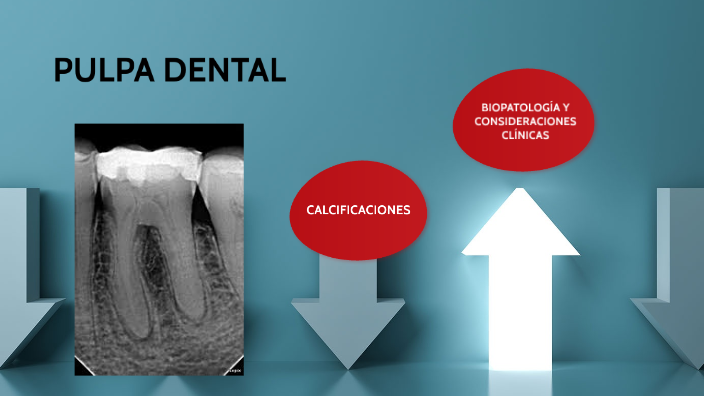 CALCIFICACIONES by MARIAJOSE SANTILLAN on Prezi