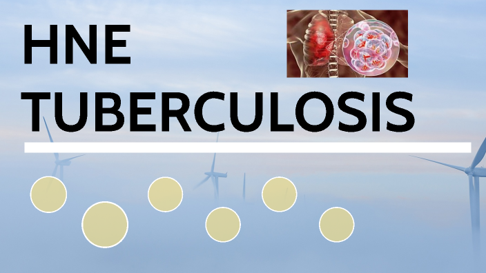 HNE TUBERCULOSIS by erika achance on Prezi