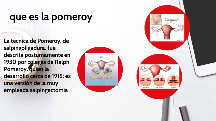 que es la pomeroid by Lizeth Arteaga on Prezi