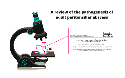 A review of the pathogenesis of adult peritonsillar abscess by Rasha ...
