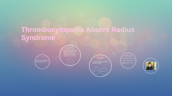 Thrombocytopenia Absent Radius Syndrome by alissa alvarado on Prezi