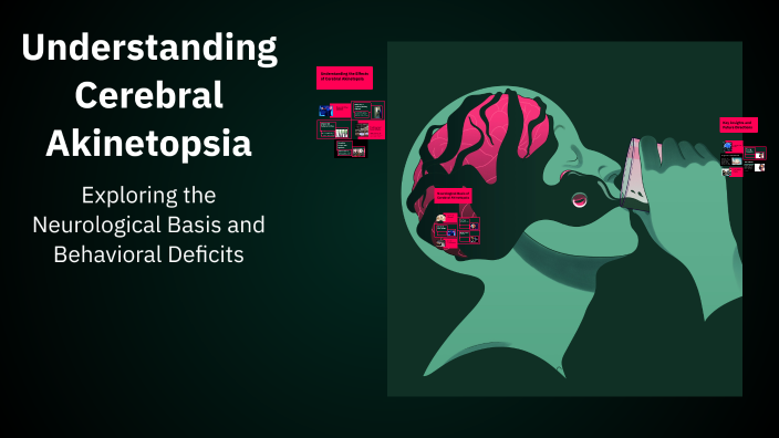 Understanding Cerebral Akinetopsia by Rebecca Chavez on Prezi