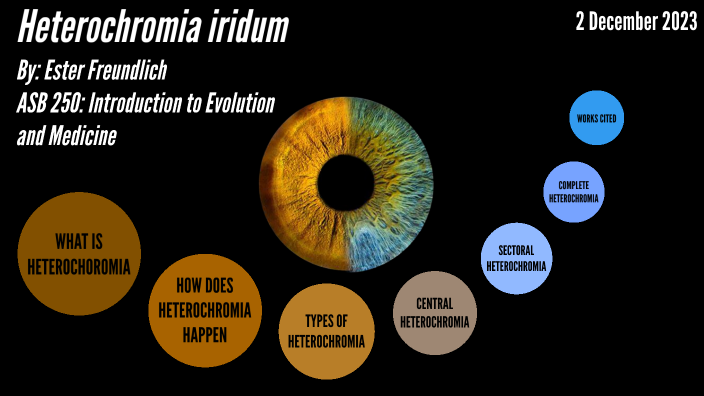 Heterochromia iridum - Ester Freundlich by Ester Freundlich on Prezi