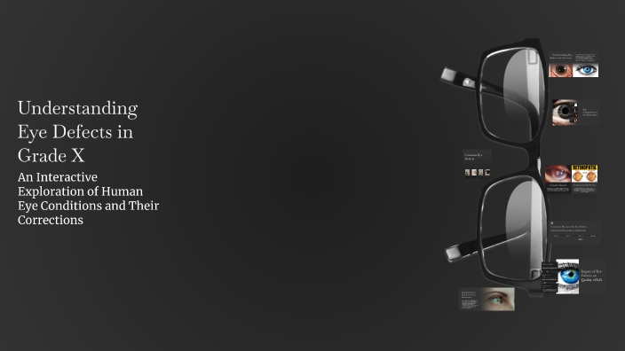 Understanding Eye Defects in Grade X by Vijay 2025 on Prezi