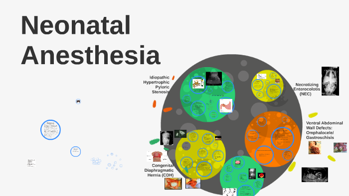 Neonatal Anesthesia by Mark Blazey on Prezi