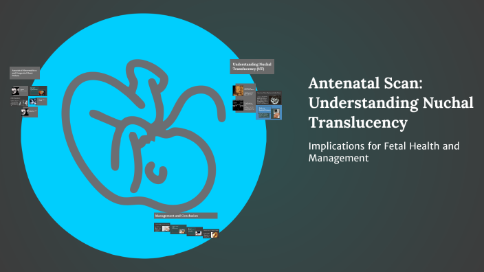 Antenatal Scan: Understanding Nuchal Translucency by on Prezi