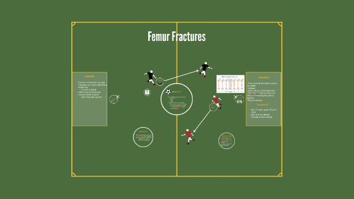 Femur Fractures by Danielle Acuna on Prezi