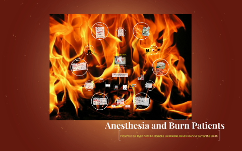 Anesthesia and Burn Patients by Devan Keane on Prezi