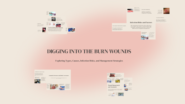 DIGGING INTO THE BURN WOUNDS by Yashashwi Karki on Prezi