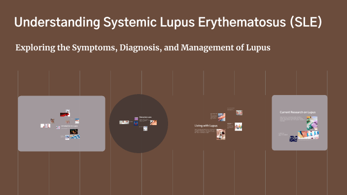 Understanding Lupus: A Comprehensive Overview by Julia Verbrugge on Prezi