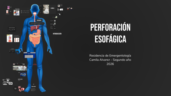 Perforación Esofágica Actualizada by Camila Alvarez on Prezi