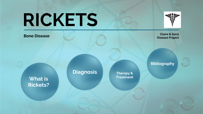 Rickets Presentation by SARAI CRUZCAMACHO on Prezi