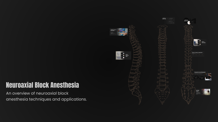 Neuroaxial Block Anesthesia by mehmet yalvaç on Prezi