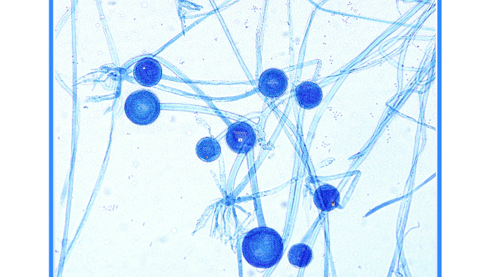 Zigomicetos by Alba Couto on Prezi