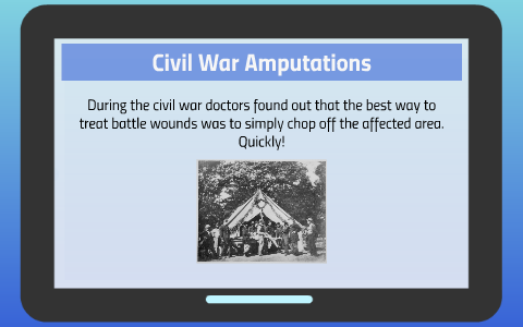 Civil War Amputations by Devin Beck on Prezi