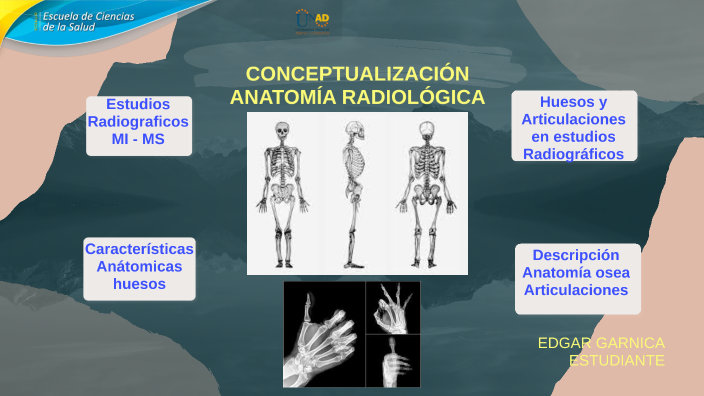 Anatomía Radiológica Edgar Garnica by Edgar Garnica on Prezi