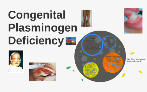 Congenital Plasminogen Deficiency by Alex Herman on Prezi