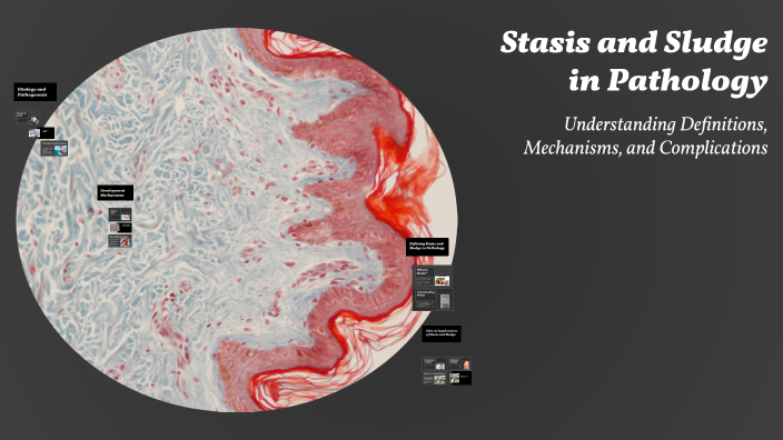Stasis and Sludge in Pathology by Usman Dhillon on Prezi